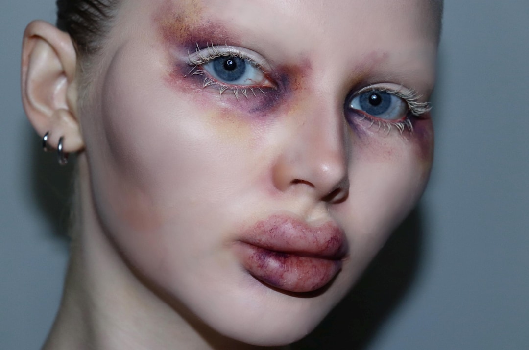 Plastic Surgery Cheekbone Prosthetics // Encapsulated Silicone ...