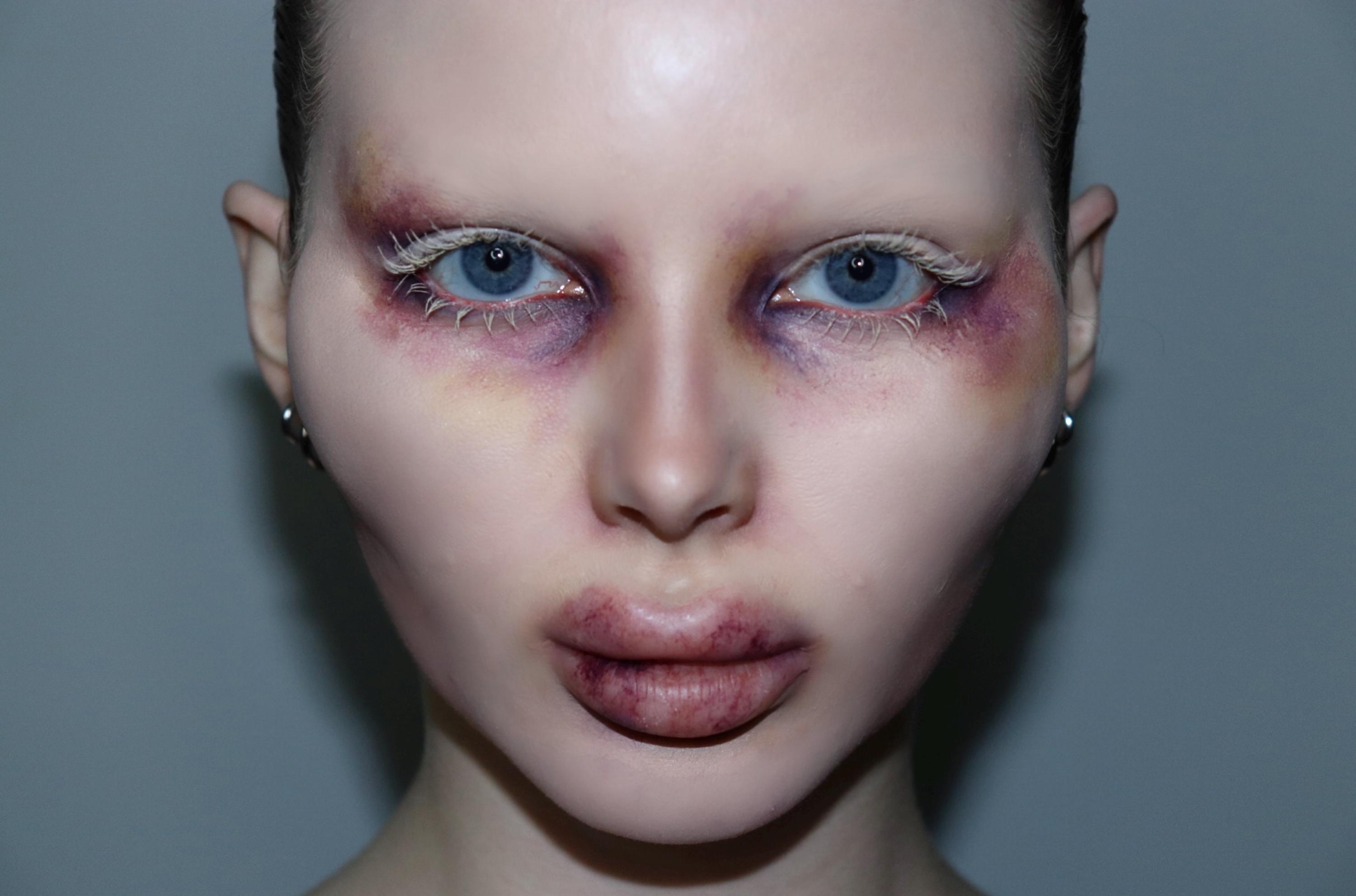 Plastic Surgery Cheekbone Prosthetics // Encapsulated Silicone ...