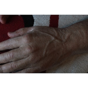 Old Age Hand Prosthetics // Encapsulated Silicone Appliances // Aging ...