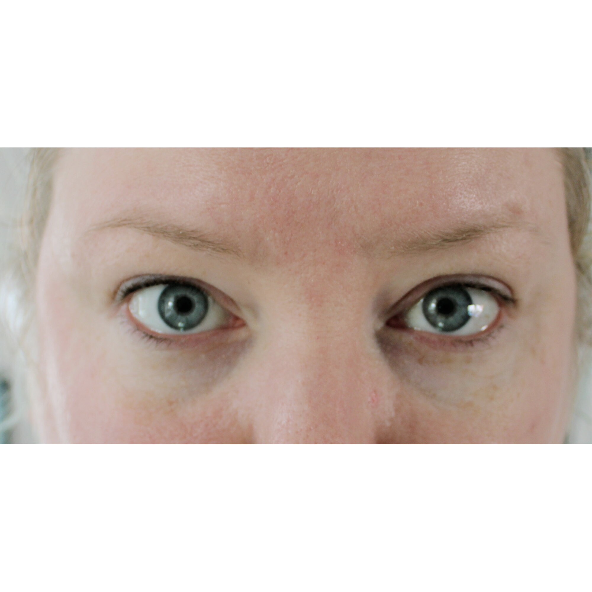 Old Age Eye Bag Prosthetics // Encapsulated Silicone // Ageing ...