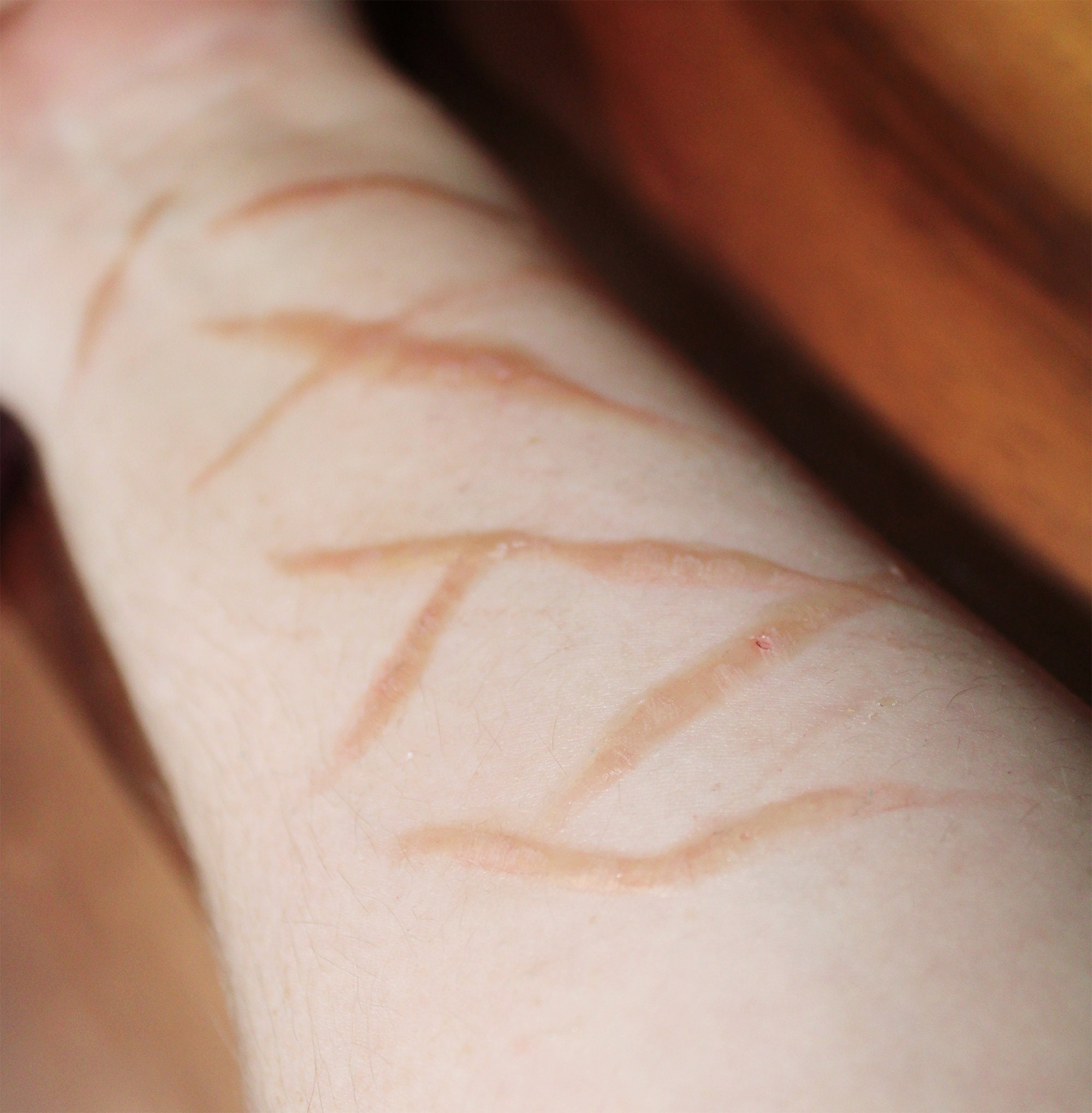 Accessories Costume Accessories Bite Wound Silicone Bondo Mould SFX ...