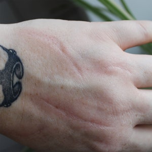 Six Indented Scar Moulds 2 Silicone Bondo Moulds for Professional ...