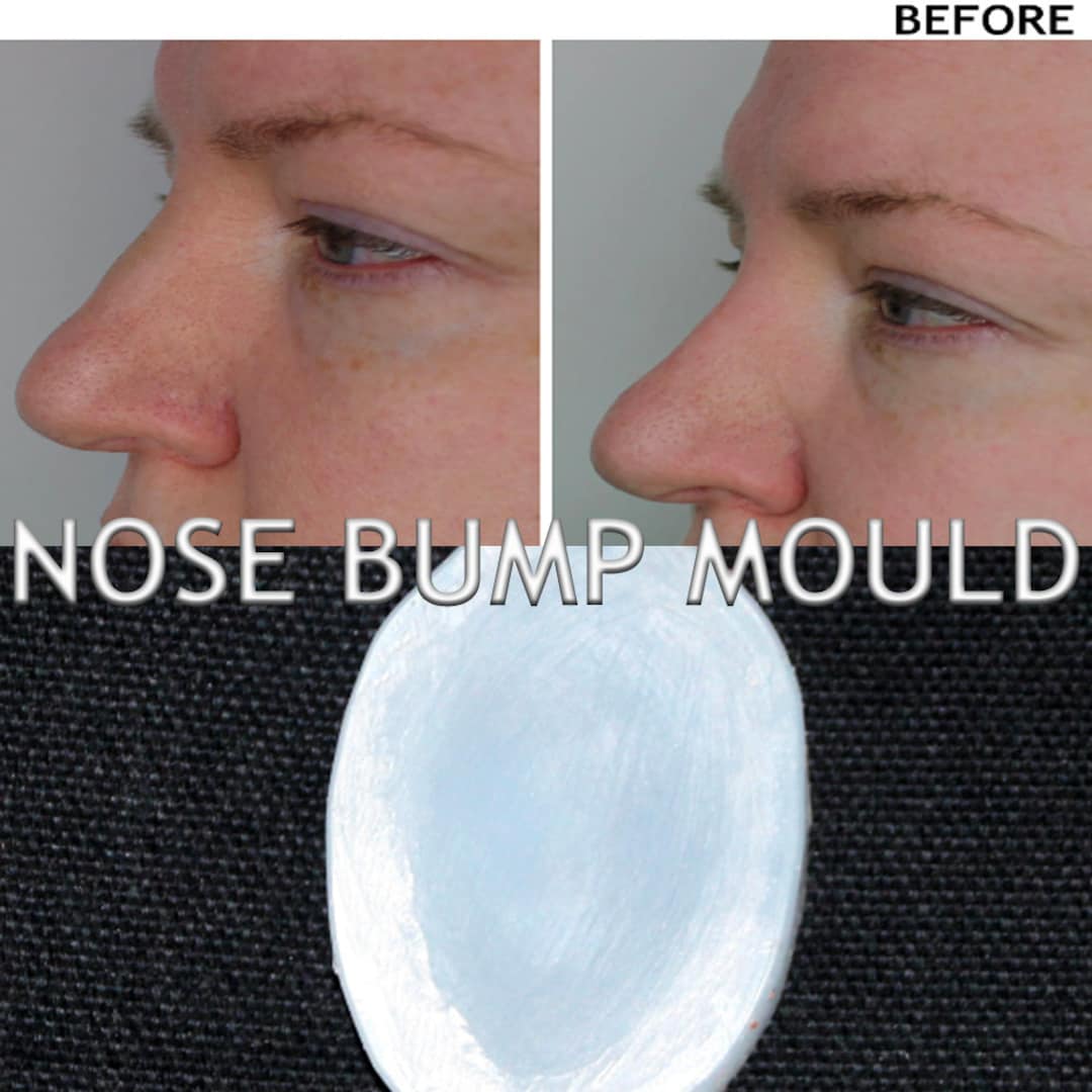 Nose Bump Small Bondo Mould // Silicone Moulds // Prosthetics SFX ...