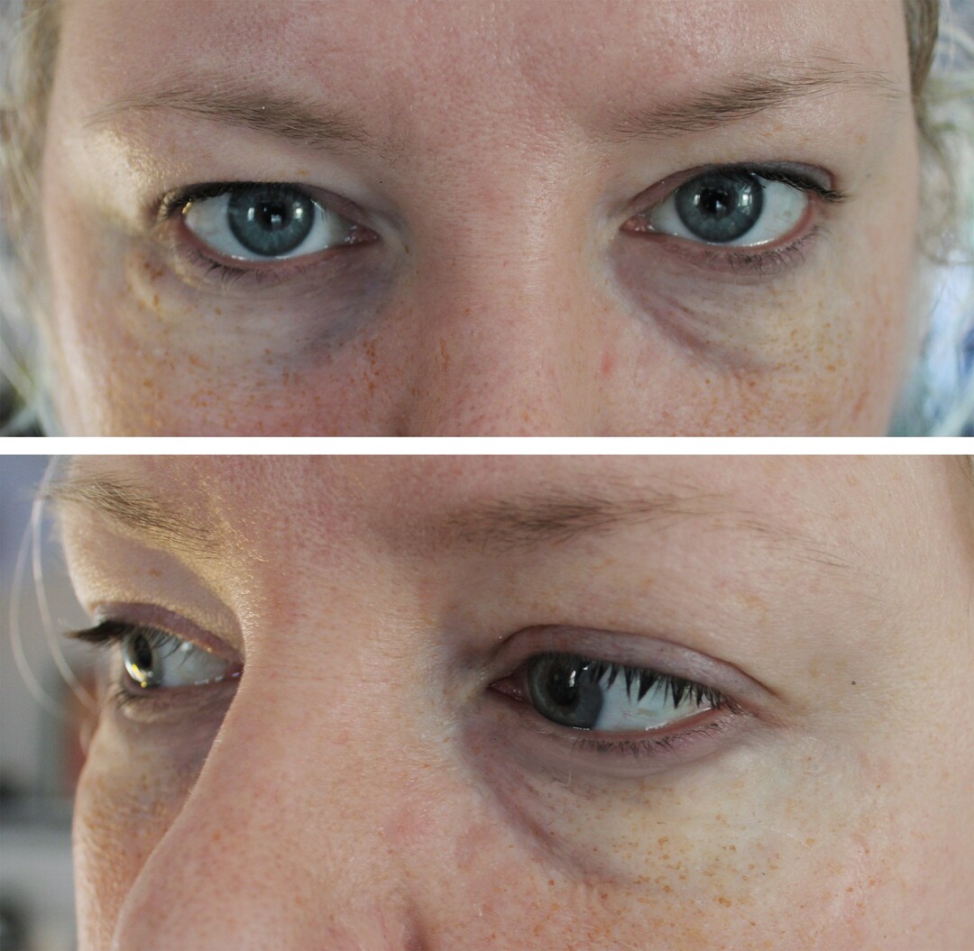 Old Age Eye Bag Prosthetics // Encapsulated Silicone // Ageing ...