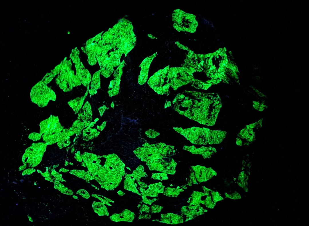 SW + LW UV Fluorescent Troostite Willemite W/ Orange Zincite, Fibrous ...