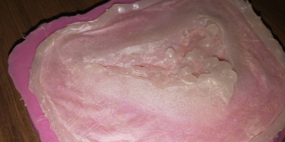 Triangle Wound With Leaking Fatty Tissue Encapsulated Silicone - Etsy