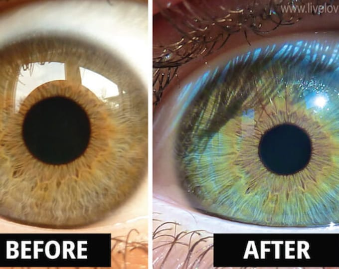 Iridology Chart, Iridology Map of the Eye Pupil. up to 20 X 30 Inches ...