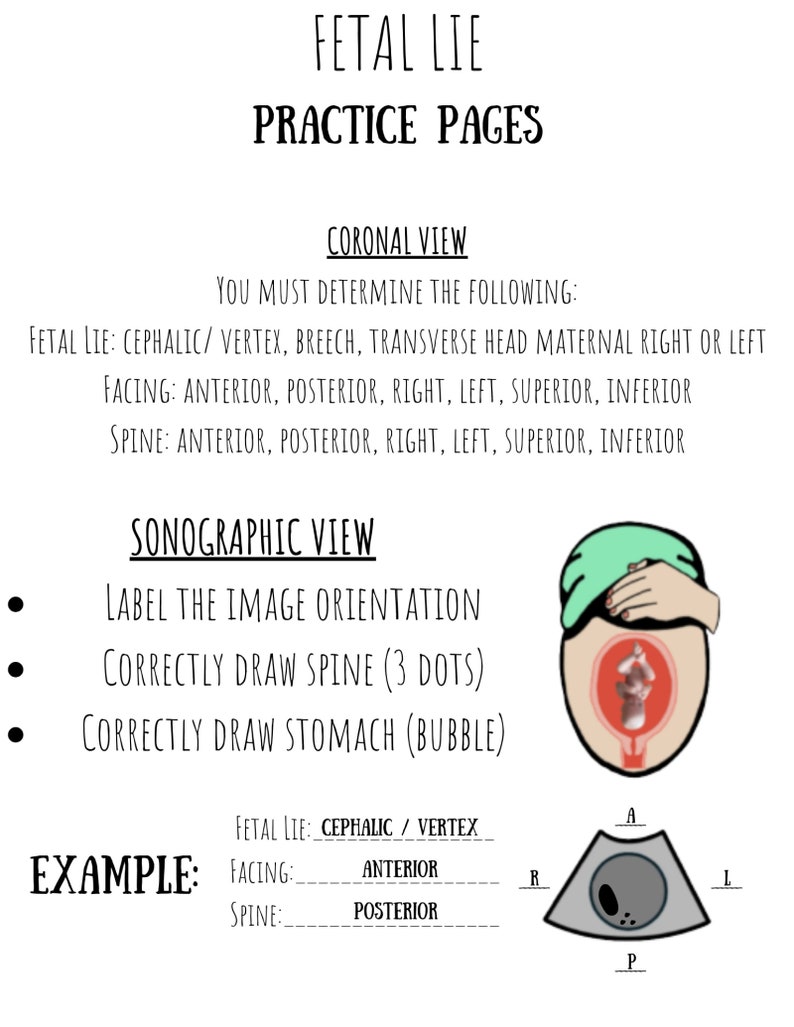 Ultrasound Study Guide: Fetal Lie / Fetal Situs - Etsy