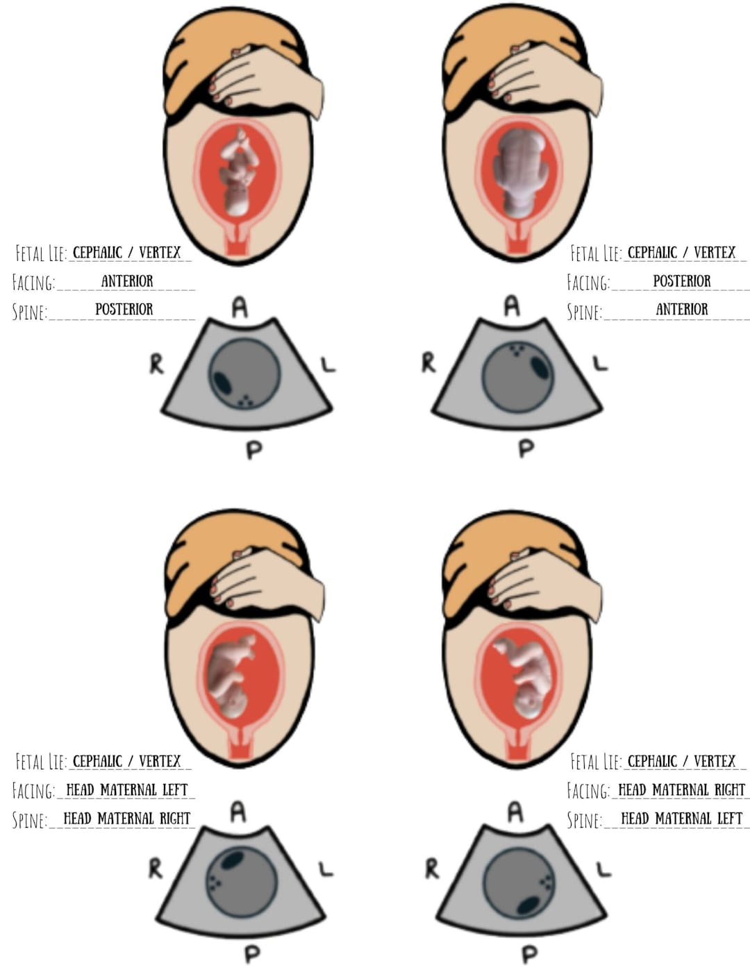 Ultrasound Study Guide: Fetal Lie / Fetal Situs - Etsy