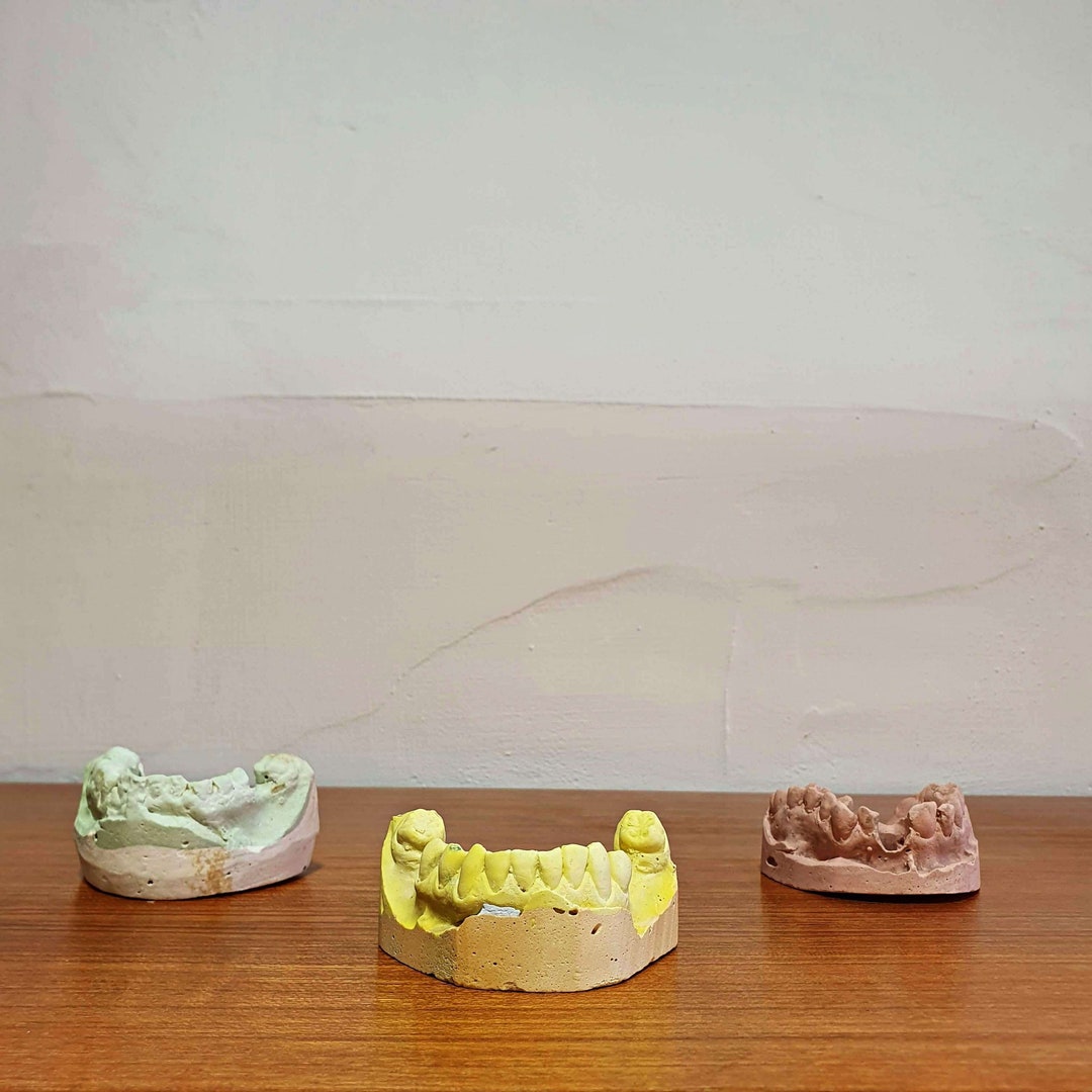 Vintage Teeth, Dental Plaster Moulds, Teeth Impressions, Tooth Display ...