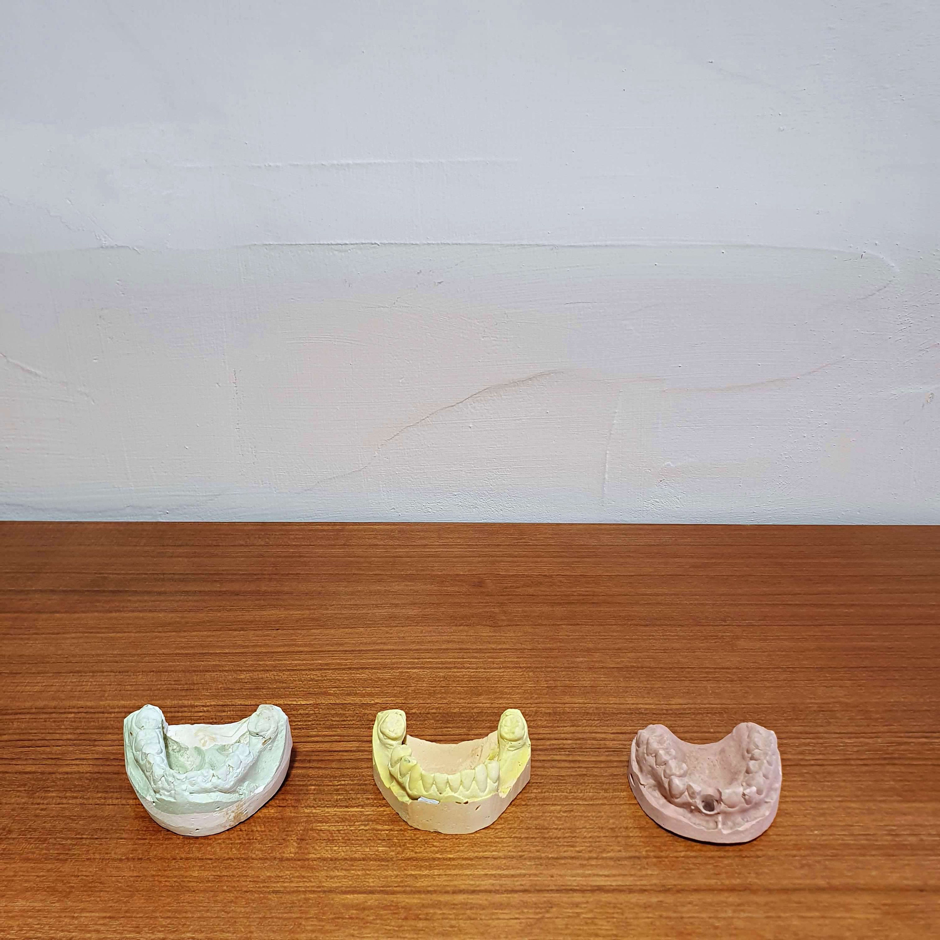 Vintage Teeth Dental Plaster Moulds Teeth Impressions Tooth - Etsy