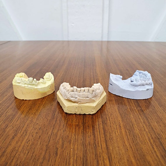 Vintage Teeth Dental Plaster Moulds Teeth Impressions Tooth - Etsy