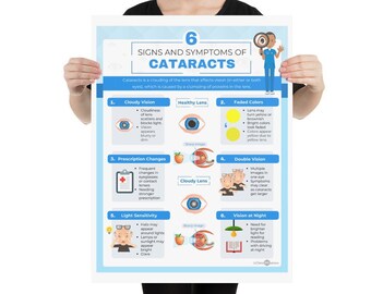 Cataracts Poster - Etsy