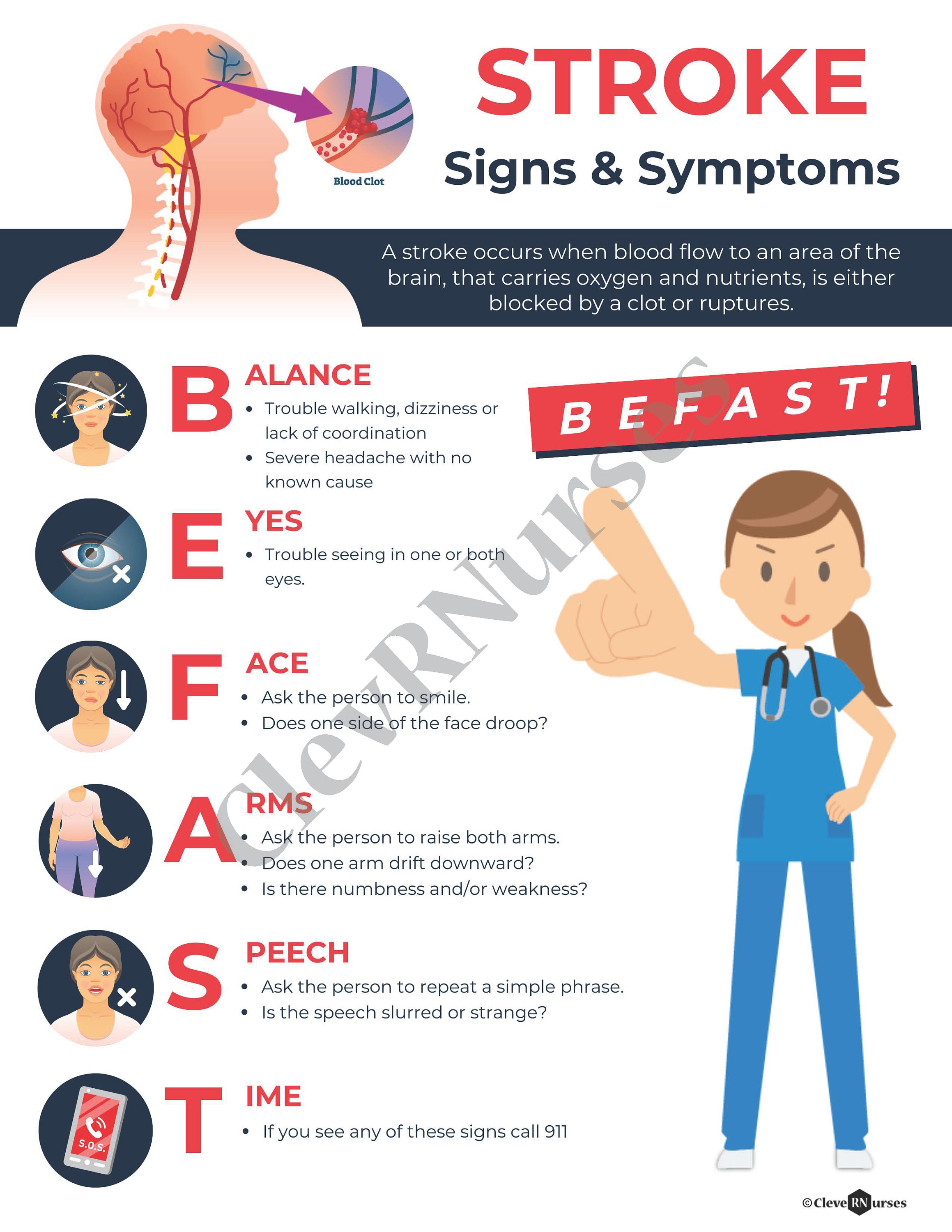 Signs of Stroke Print DIGITAL DOWNLOAD Cardiologist Gift - Etsy