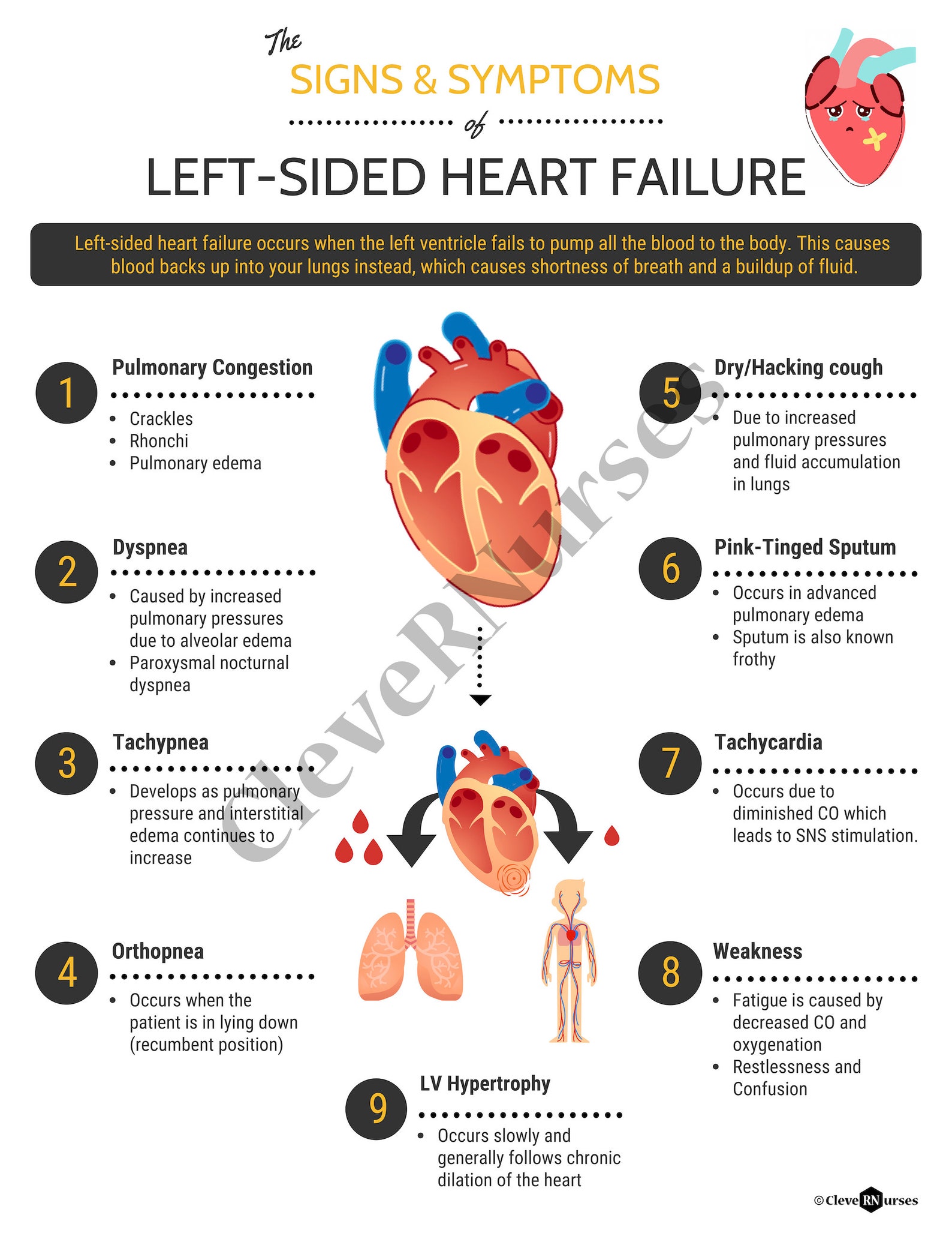 Signs of Left Sided Heart Failure Print DIGITAL DOWNLOAD - Etsy