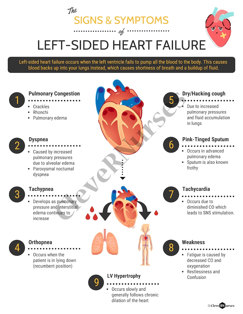 Signs of Left Sided Heart Failure Print DIGITAL DOWNLOAD - Etsy
