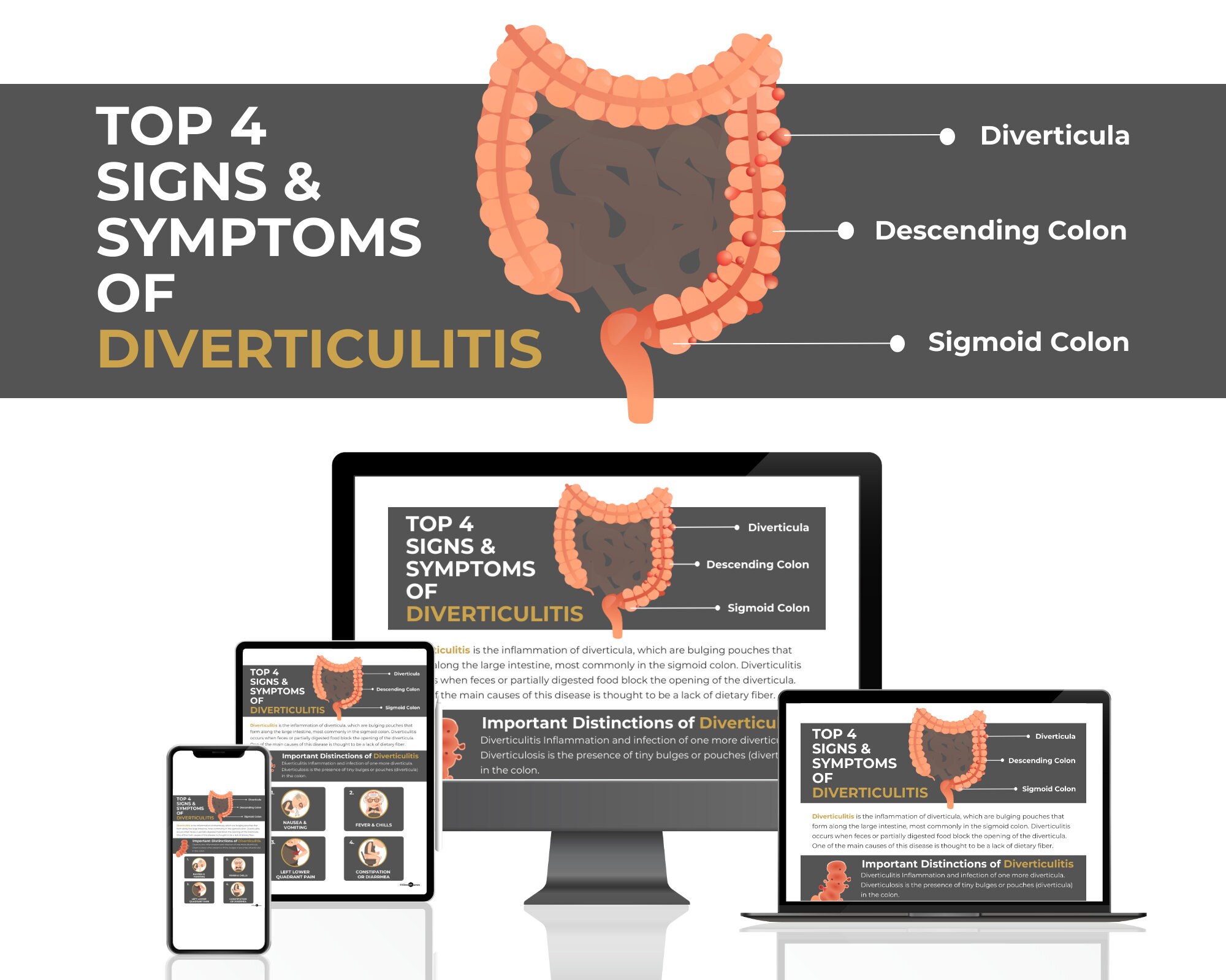 Signs of Diverticulitis Print DIGITAL DOWNLOAD Gastroenterologist Gift ...