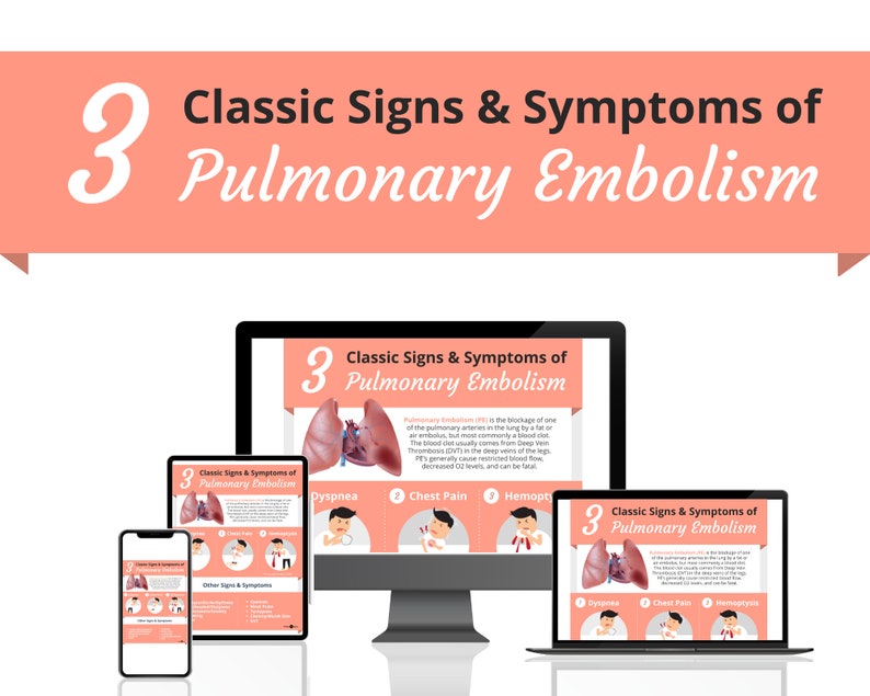 Signs of Pulmonary Embolism Print | DIGITAL DOWNLOAD | Pulmonologist ...