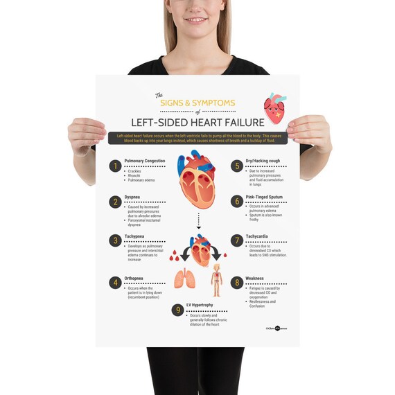Signs of Left Sided Heart Failure Print Cardiologist Gift - Etsy