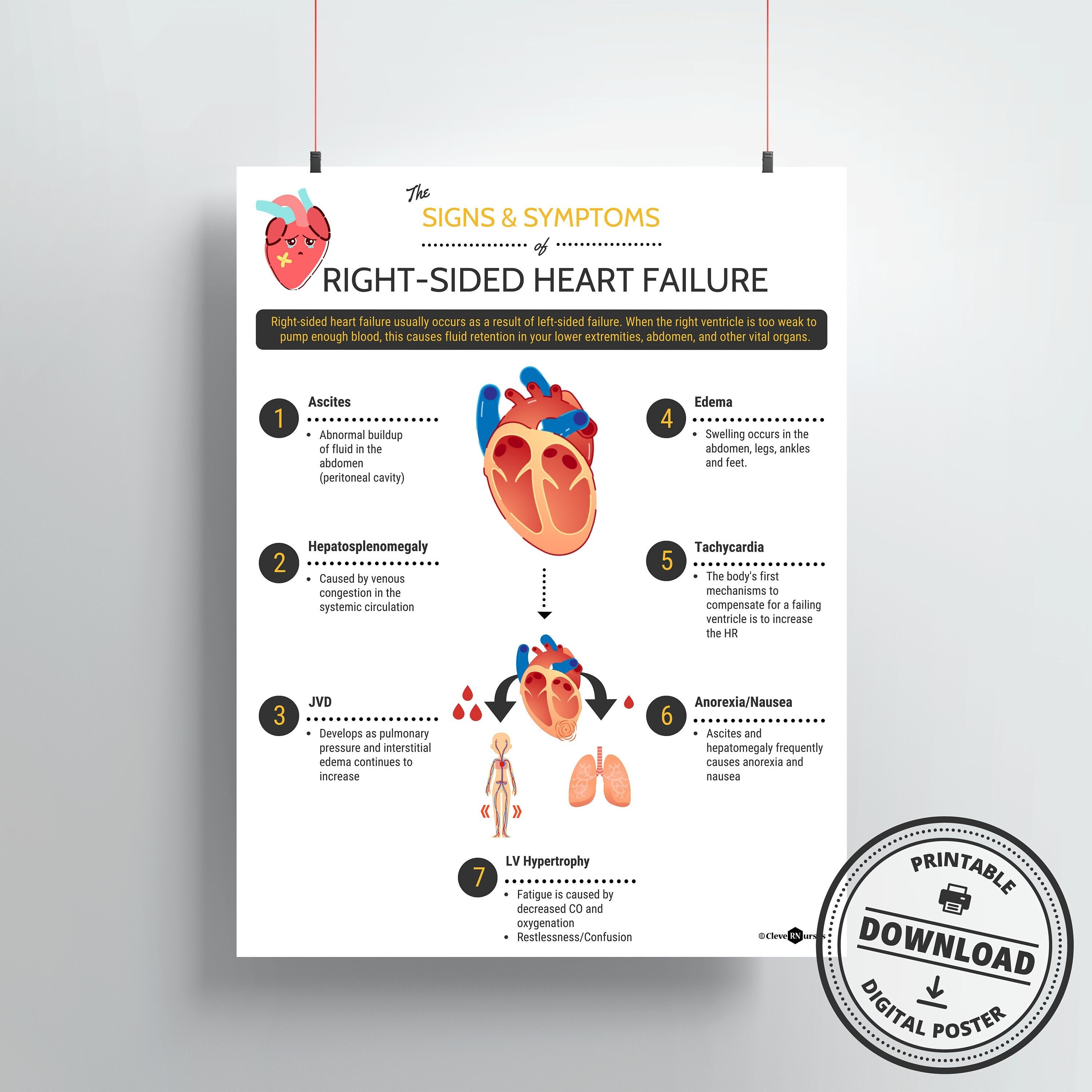 Signs of Right Sided Heart Failure Print | DIGITAL DOWNLOAD ...