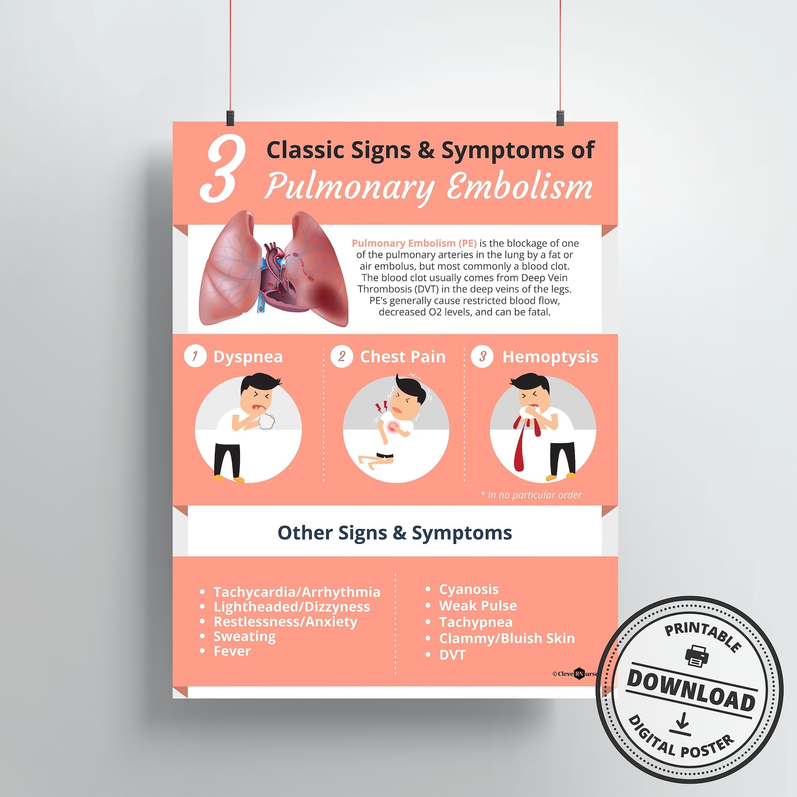 Signs of Pulmonary Embolism Print | DIGITAL DOWNLOAD | Pulmonologist ...