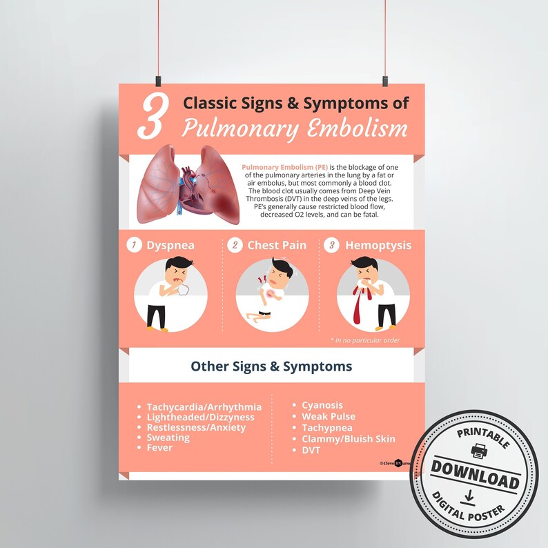 Signs of Pulmonary Embolism Print | DIGITAL DOWNLOAD | Pulmonologist ...