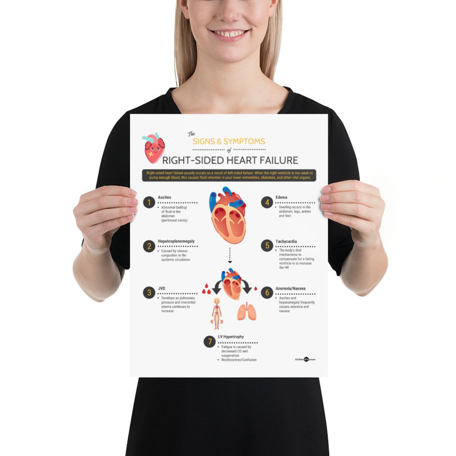 Signs of Right Sided Heart Failure Print | Cardiologist Gift | Doctor ...