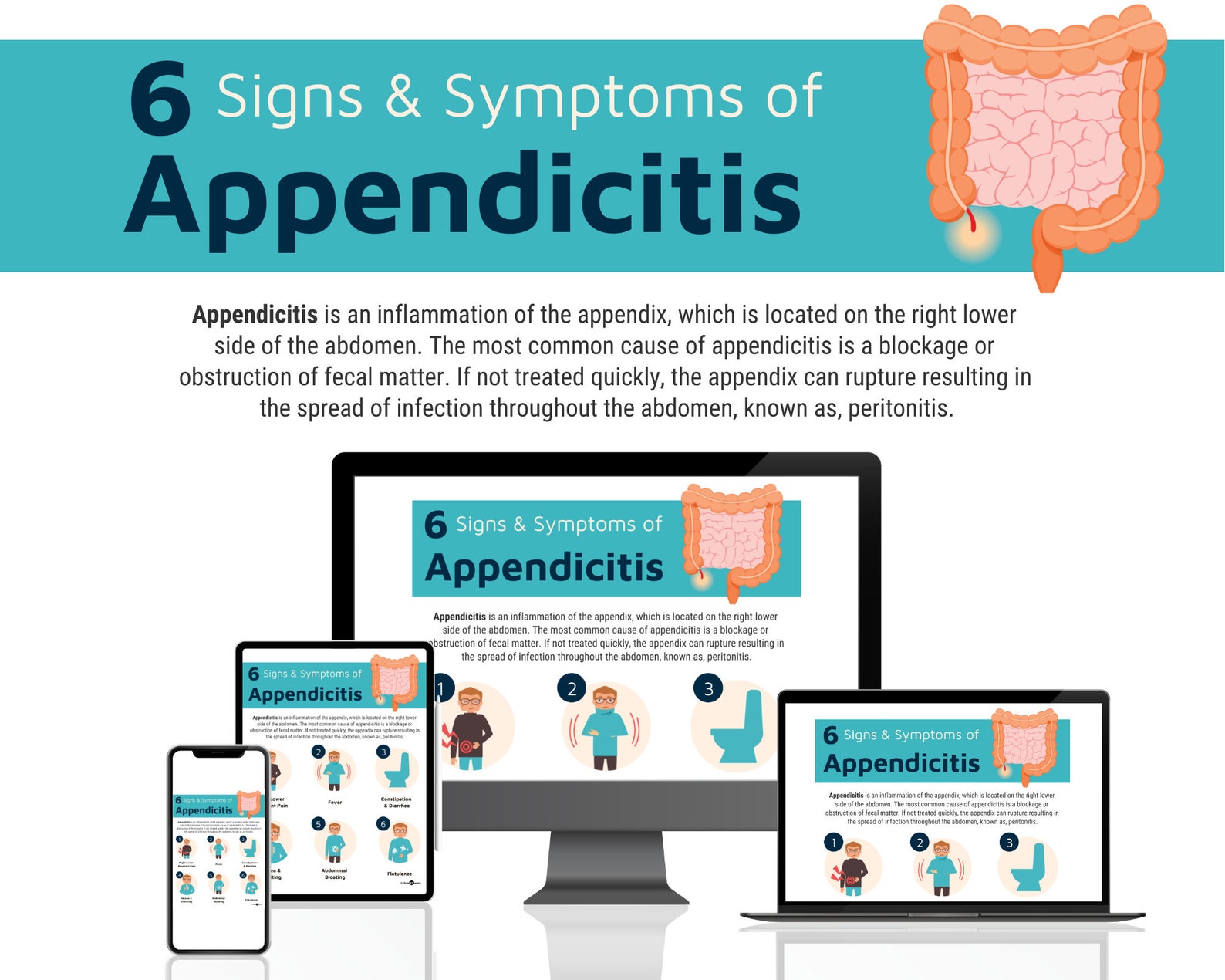 Signs of Appendicitis Print | DIGITAL DOWNLOAD | Gastroenterologist ...