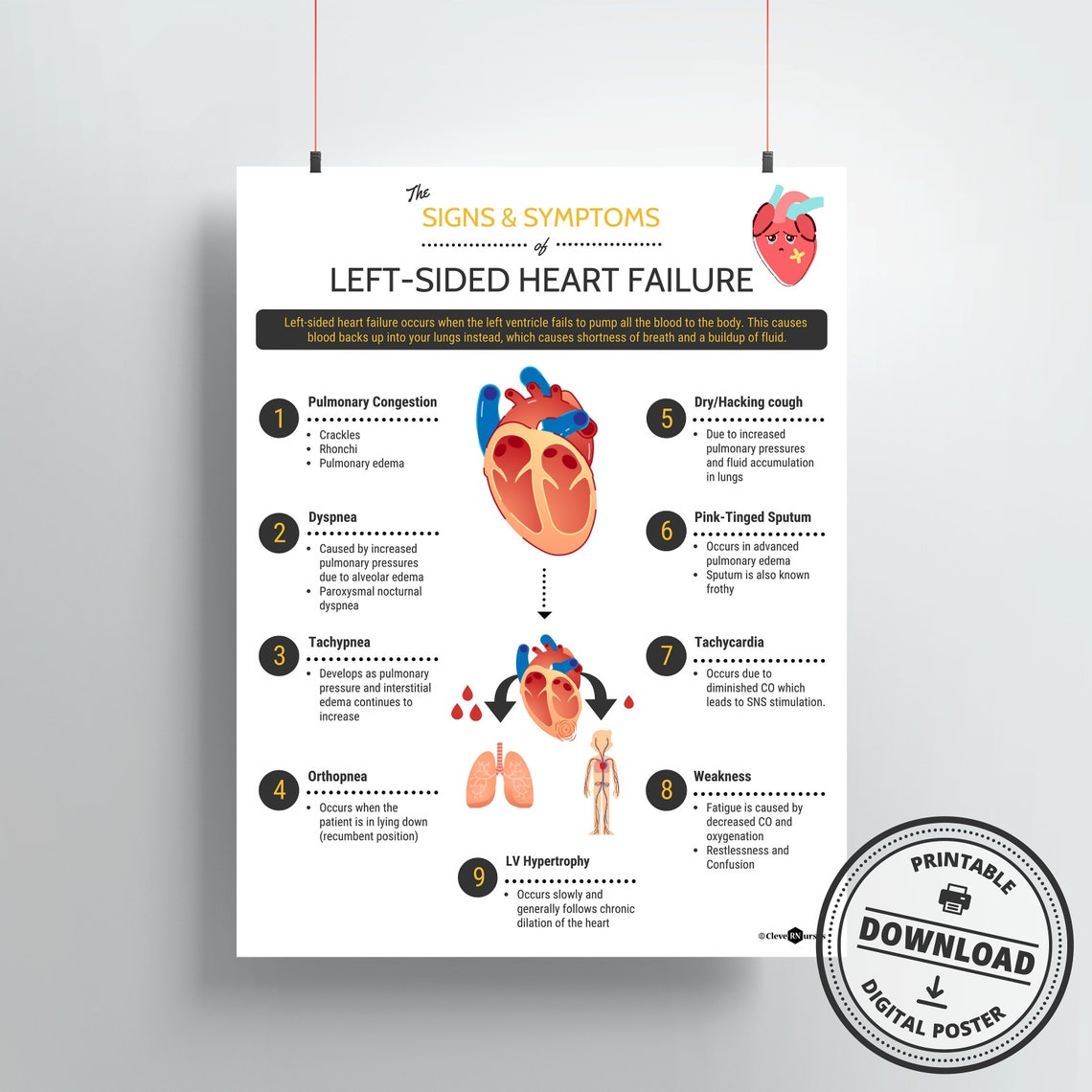 Signs of Left Sided Heart Failure Print | DIGITAL DOWNLOAD ...