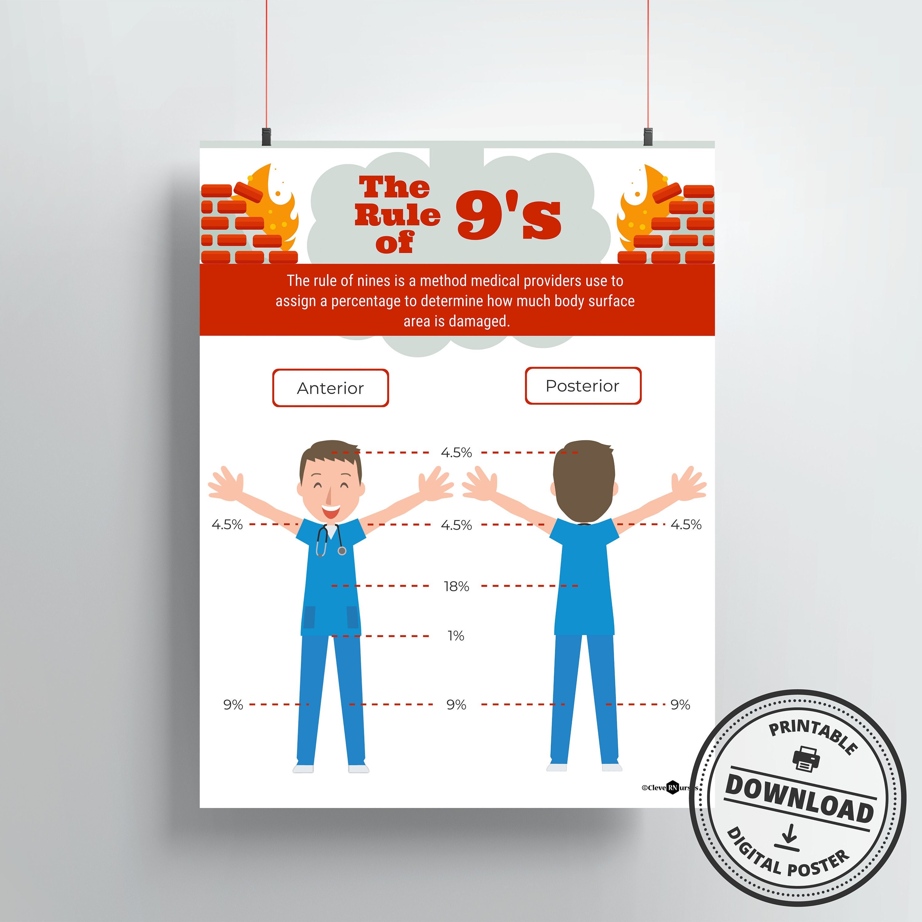 Rule of Nines Print DIGITAL DOWNLOAD Dermatologist Gift Doctor Office ...