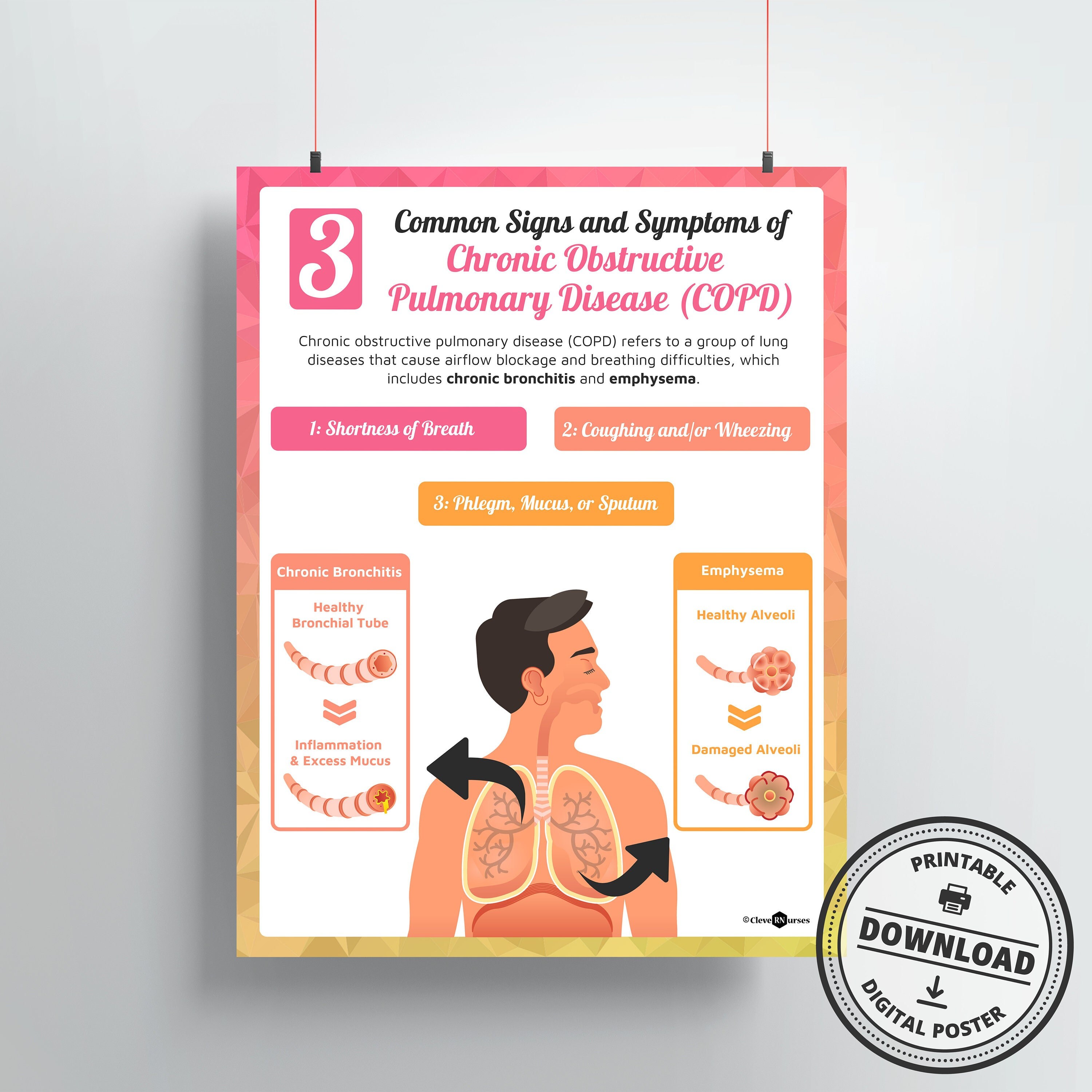 Signs of COPD Print | DIGITAL DOWNLOAD | Pulmonologist Gift | Doctor ...