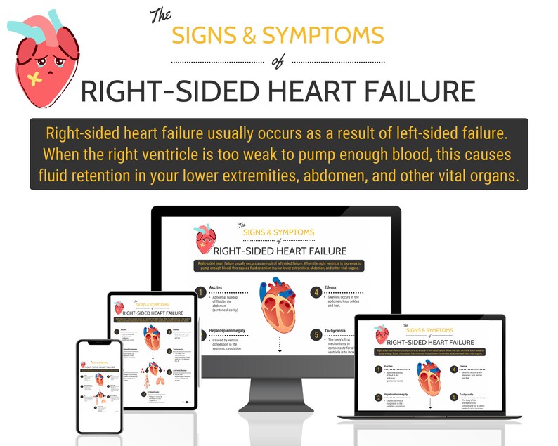 Signs of Right Sided Heart Failure Print | DIGITAL DOWNLOAD ...