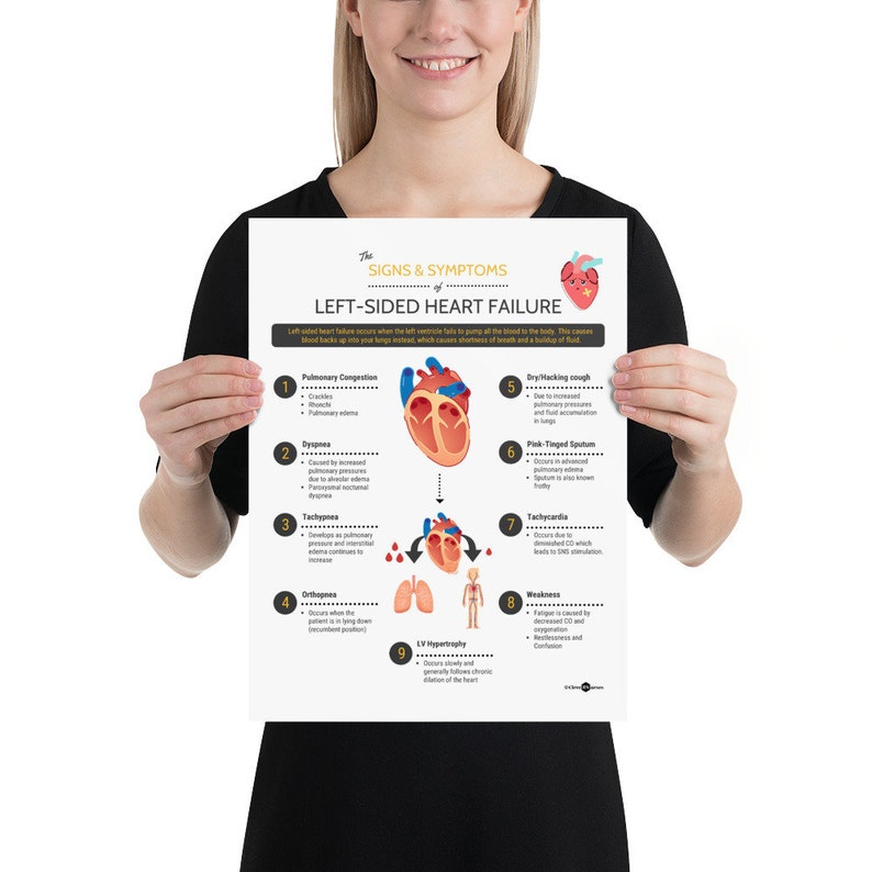 Signs of Left Sided Heart Failure Print | Cardiologist Gift | Doctor ...