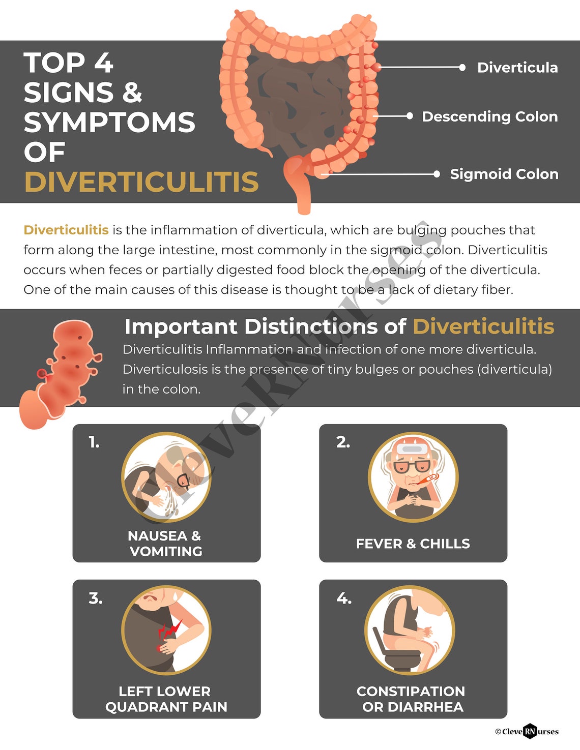 Signs of Diverticulitis Print DIGITAL DOWNLOAD - Etsy