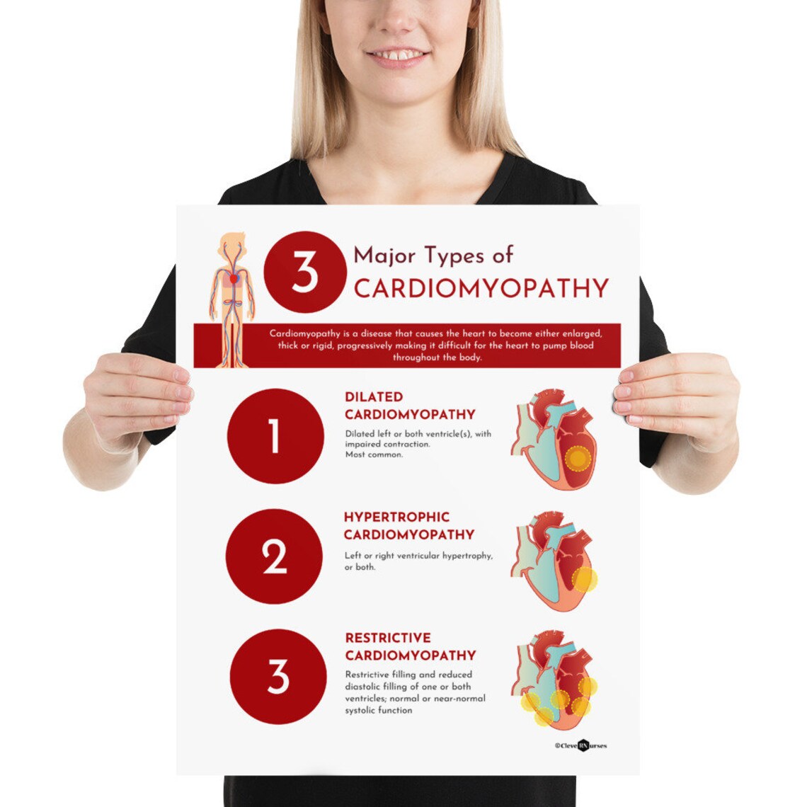 3 Major Types of Cardiomyopathy Infographic Poster | Etsy