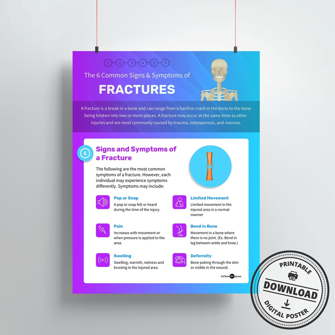 Signs of Fractures Print | DIGITAL DOWNLOAD | Orthopedic Gift | Doctor ...