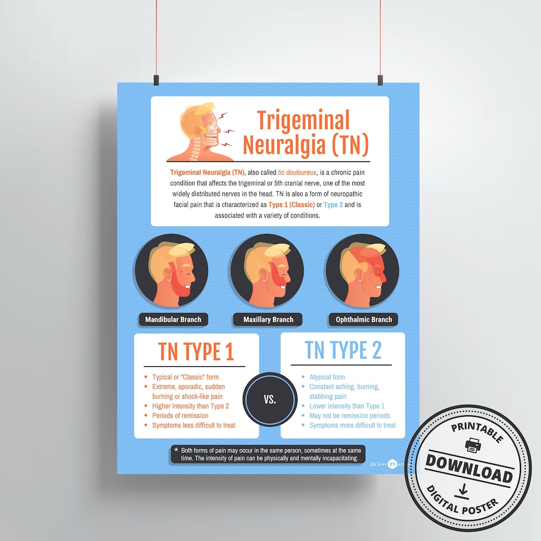 Trigeminal Neuralgia Print | DIGITAL DOWNLOAD | Neurology Gift | Doctor ...