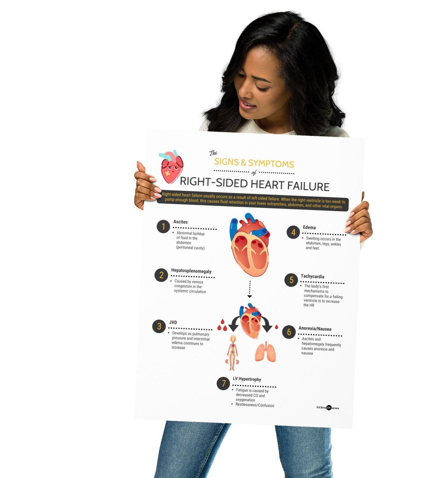 Signs of Right Sided Heart Failure Print | Cardiologist Gift | Doctor ...