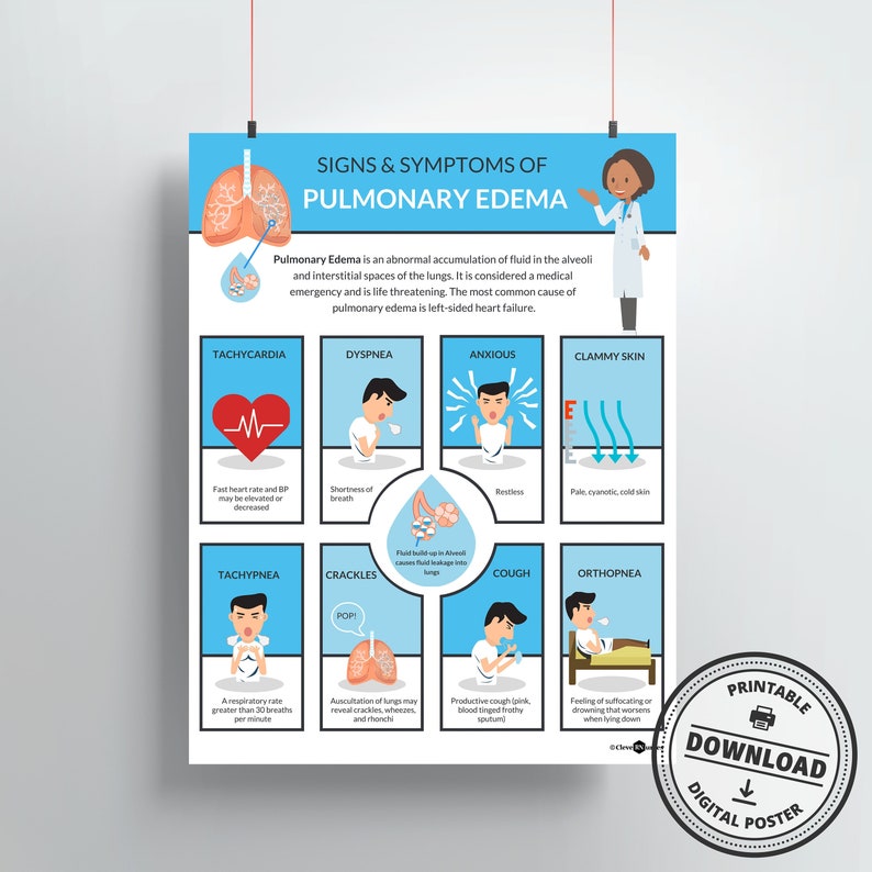 Signs of Pulmonary Edema Print | DIGITAL DOWNLOAD | Respiratory Gift ...