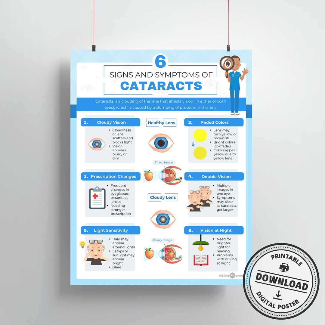 Signs of Cataracts Print | DIGITAL DOWNLOAD | Optometrist Gift | Doctor ...