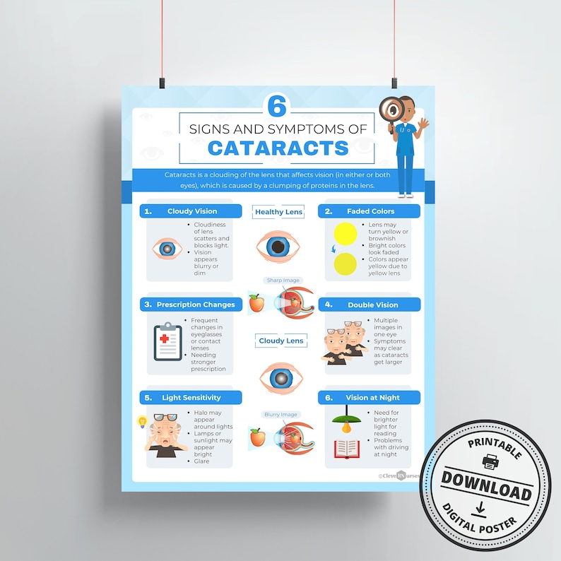 Signs of Cataracts Print | DIGITAL DOWNLOAD | Optometrist Gift | Doctor ...