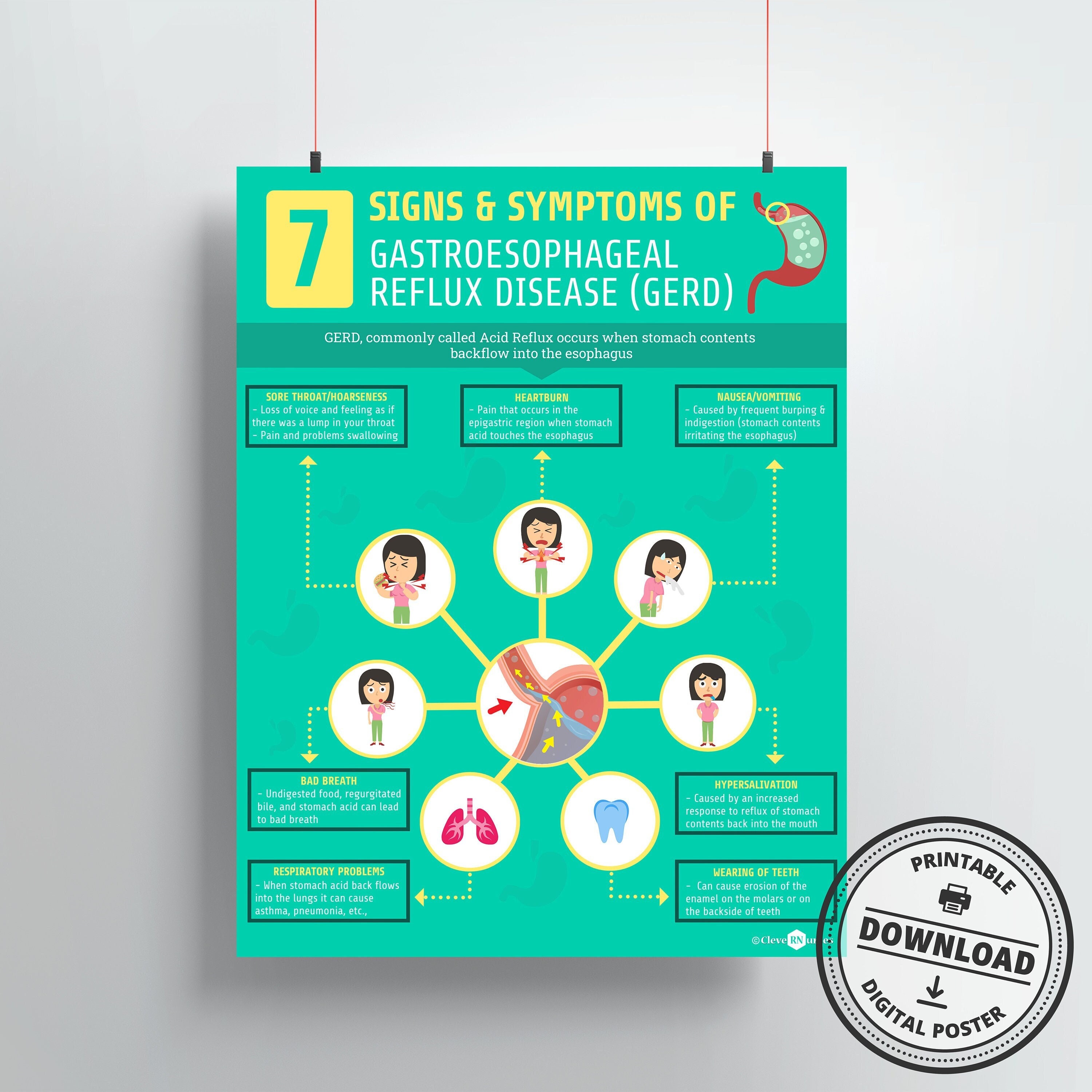 Signs of GERD Print | DIGITAL DOWNLOAD | Gastroenterologist Gift ...