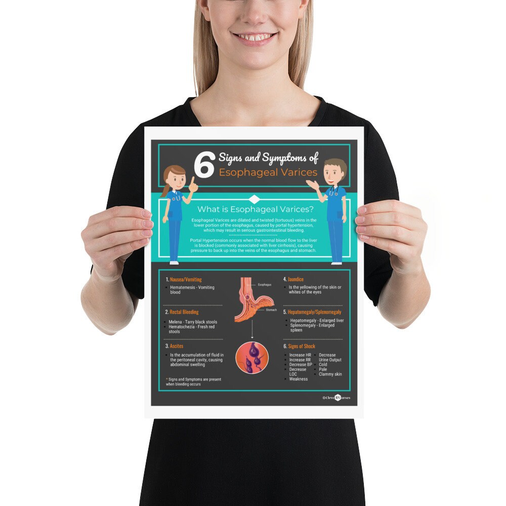 Signs of Varices Print | Gastroenterologist Gift | Doctor Office Decor ...