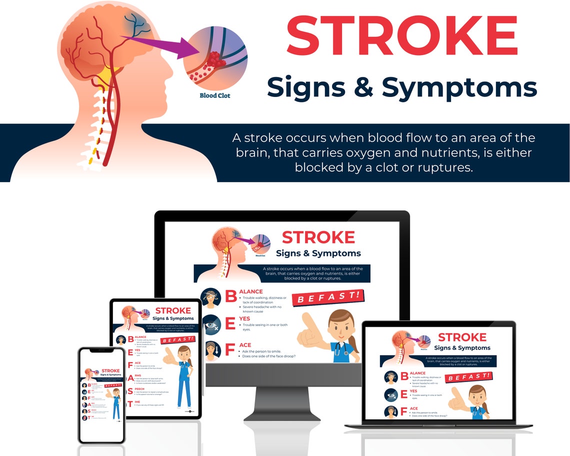 Signs Of Stroke Print Digital Download Cardiologist T Doctor Office Decor
