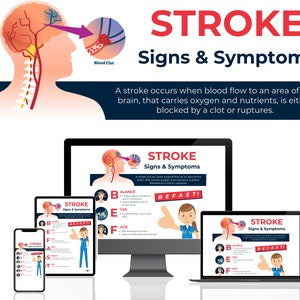 Signs of Stroke Print | DIGITAL DOWNLOAD | Cardiologist Gift | Doctor ...