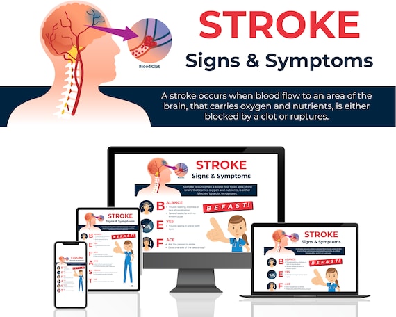 Signs of Stroke Print DIGITAL DOWNLOAD Cardiologist Gift - Etsy