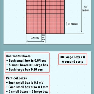 EKG Need to Knows/ Nursing/ EMT- Paramedic/ Cardiology - Etsy