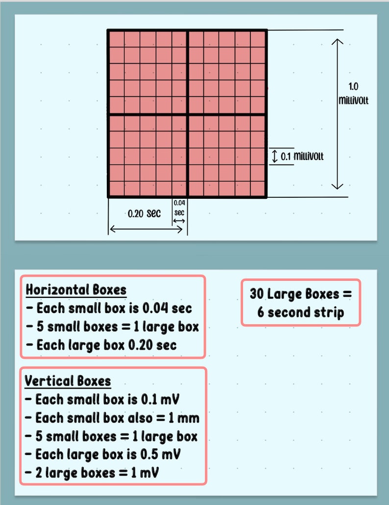 EKG Need to Knows/ Nursing/ EMT- Paramedic/ Cardiology - Etsy