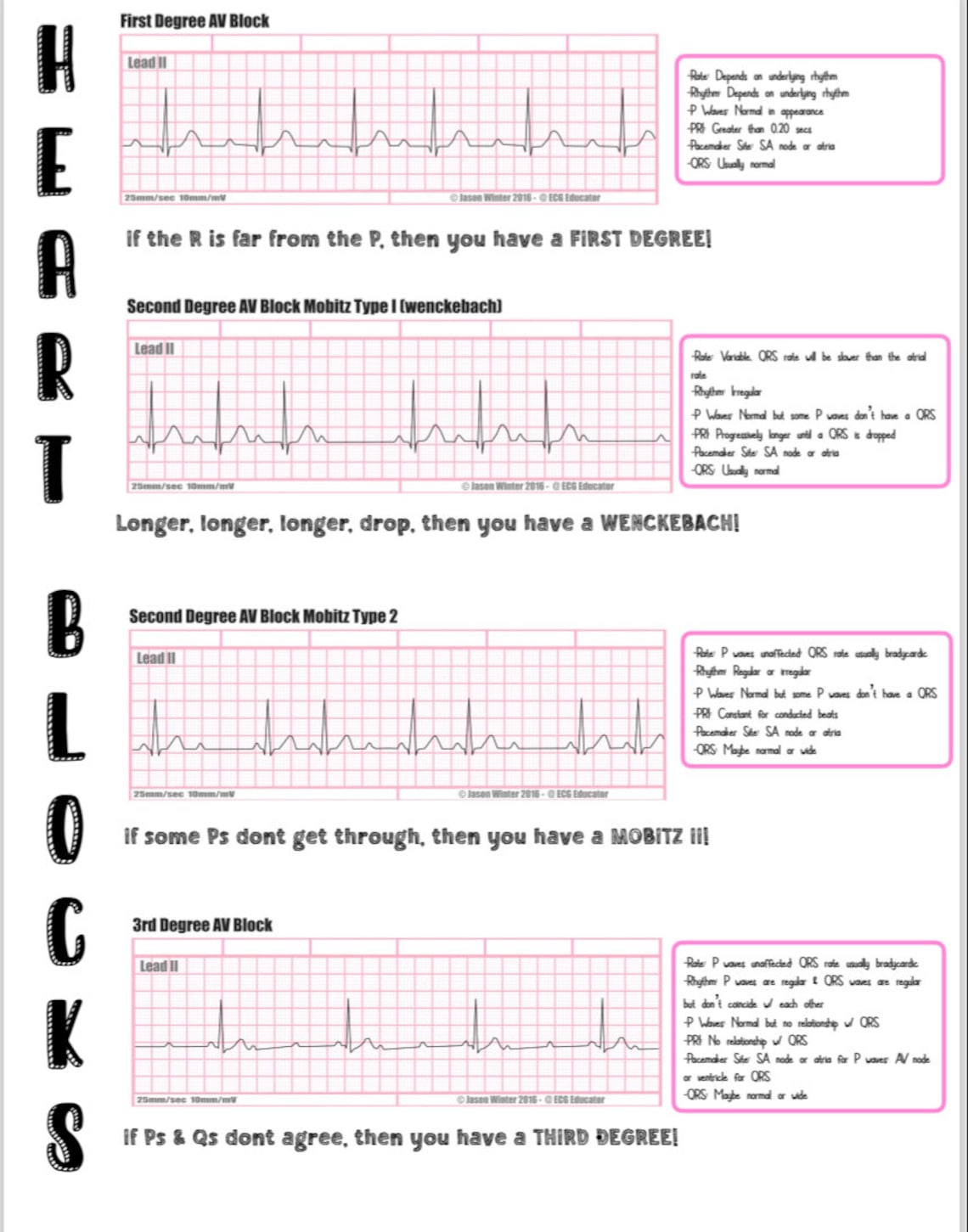 EKG Need to Knows/ Nursing/ EMT- Paramedic/ Cardiology - Etsy
