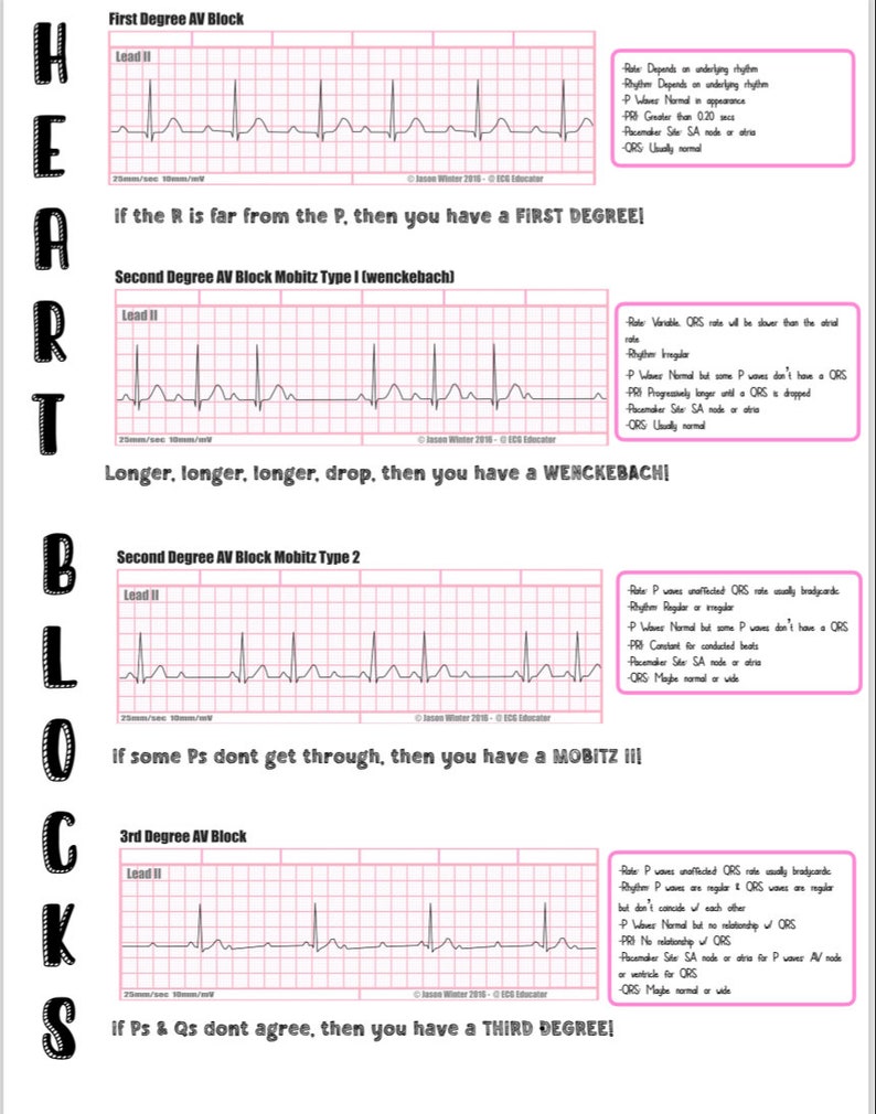 EKG Need to Knows/ Nursing/ EMT- Paramedic/ Cardiology - Etsy